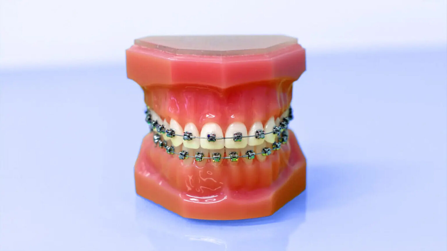 Straighten Your Smile with the Damon System - The Mint Dental